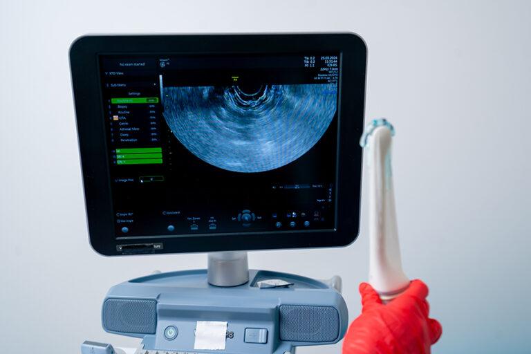 Read This First, Before You Purchase an Ultrasound Machine: A ...