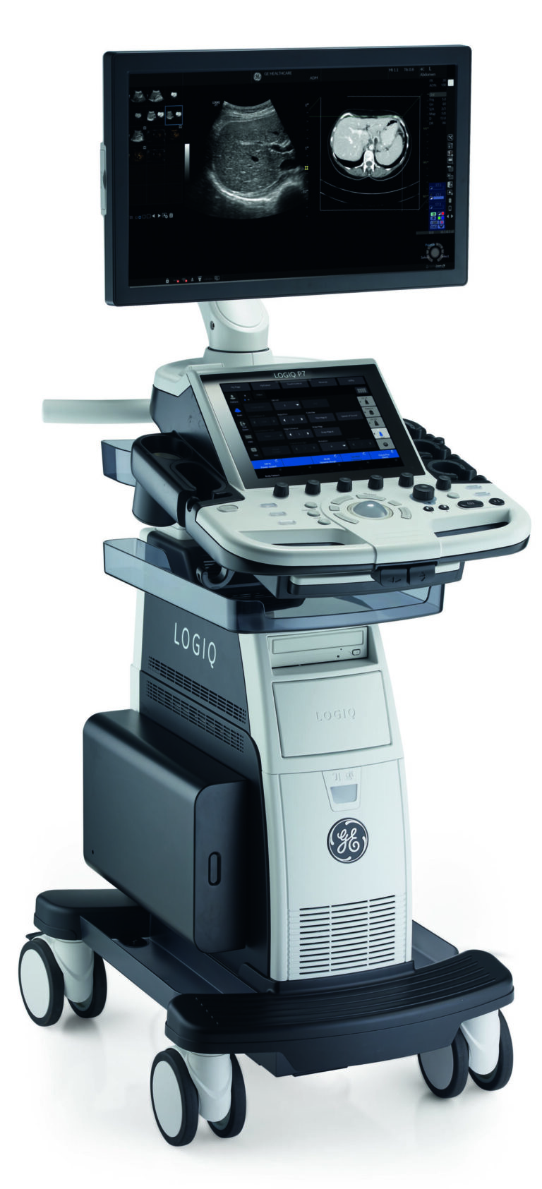 Used Ultrasound Machine for Sale - Ultrasound Scanners